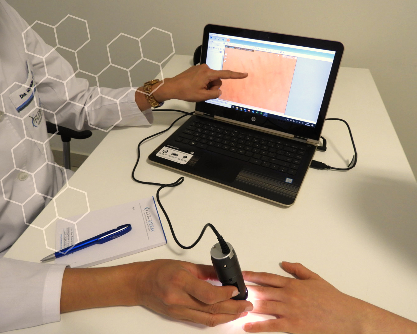 Capilaroscopia – Fleboderm Consultorios Médicos