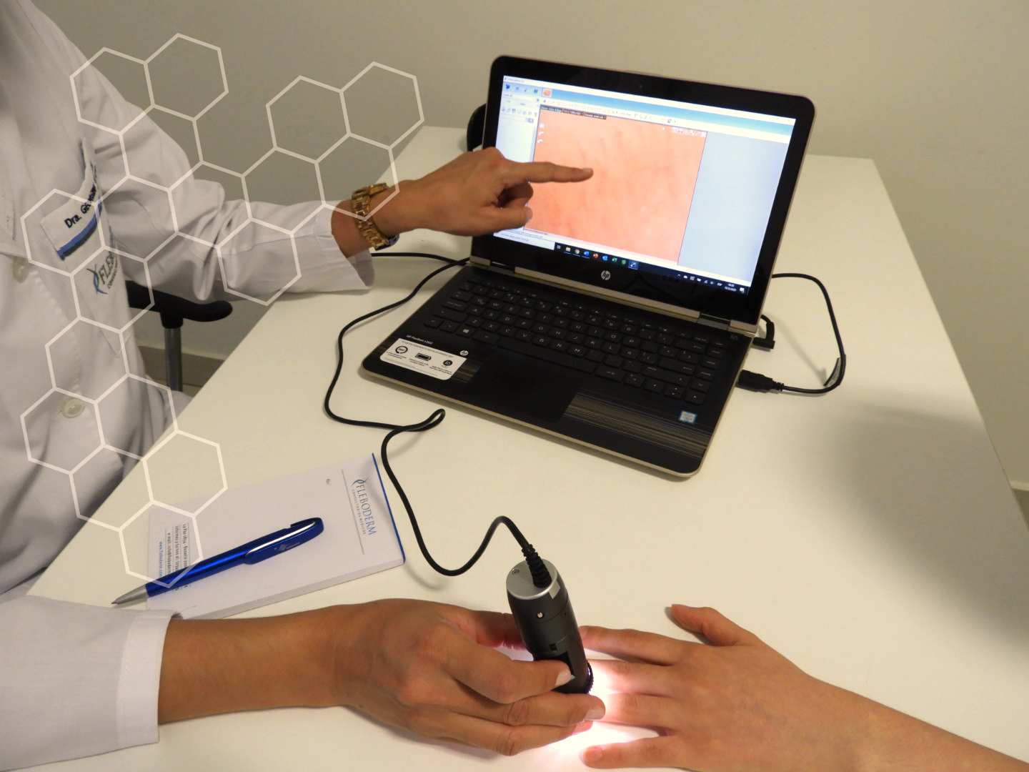 Capilaroscopia - Fleboderm Consultorios Médicos