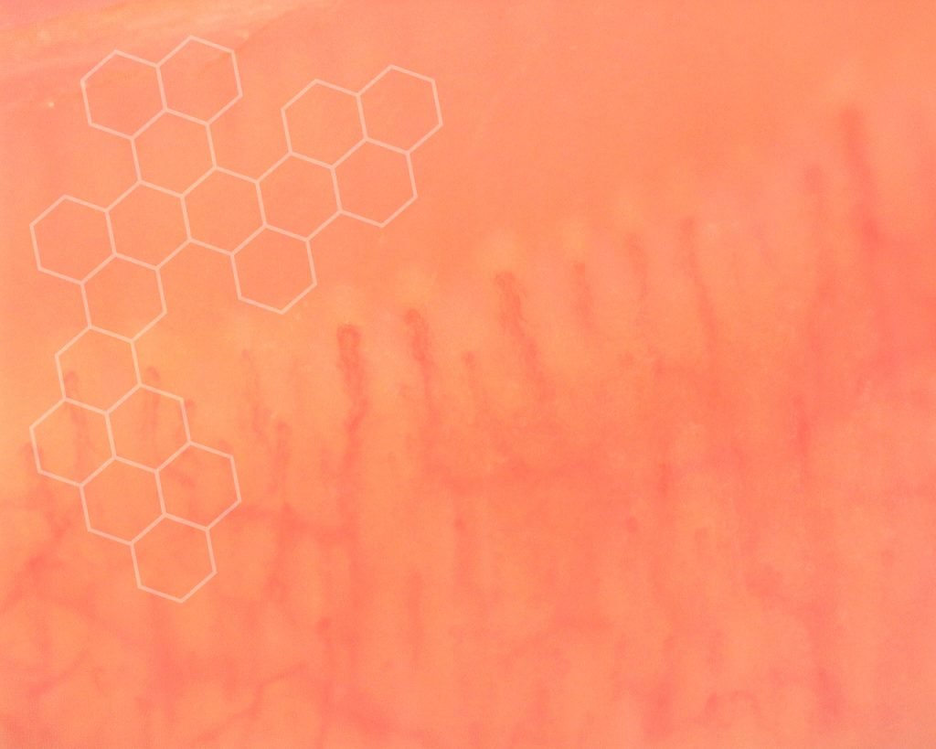 Capilaroscopia – Fleboderm Consultorios Médicos